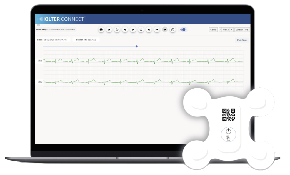 UltraLinQ Holter Service 2025 Pricing, Features, Reviews & Alternatives ...