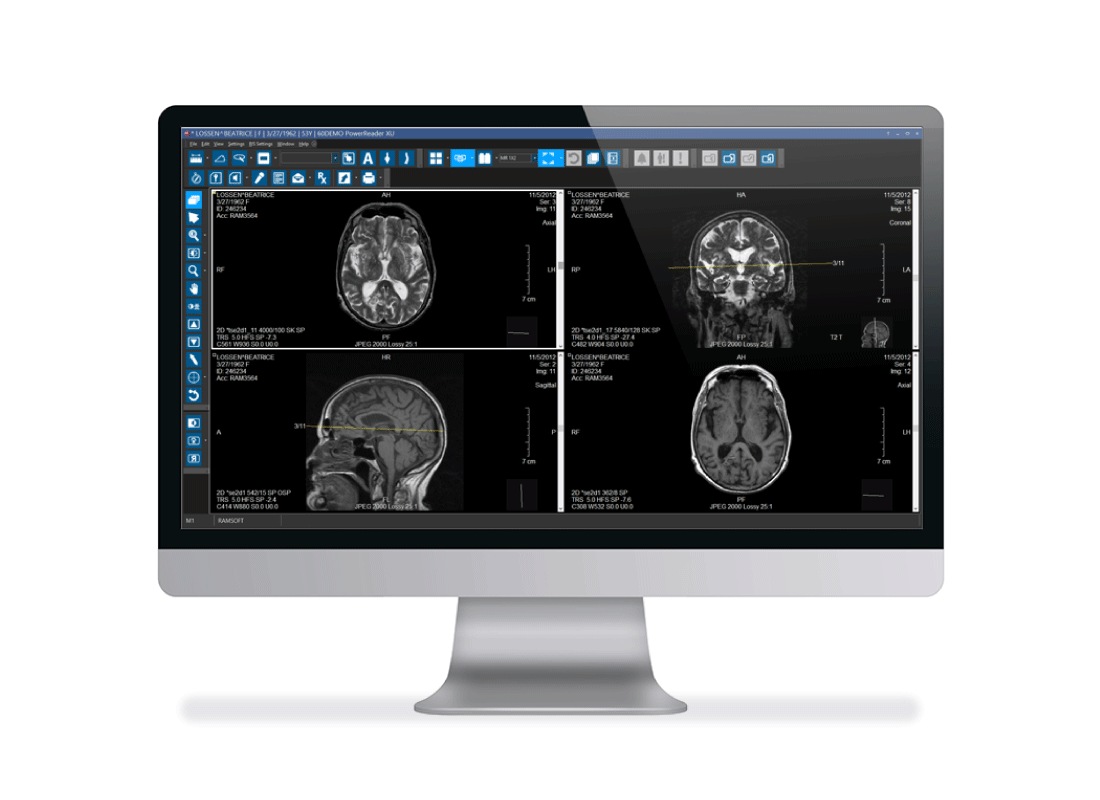PowerServer PACS | Reviews, Pricing & Demos - SoftwareAdvice IE