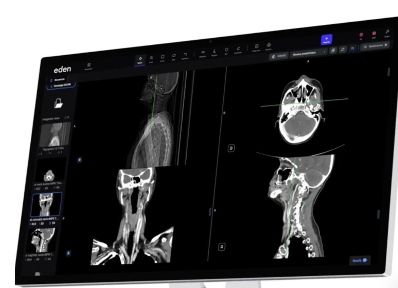 Eden - Opiniones, precios y características - Capterra España 2025