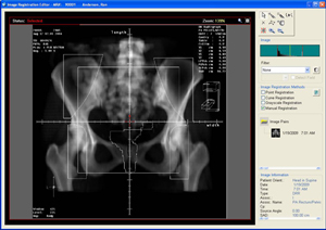 MOSAIQ Software - 2025 Reviews, Pricing & Demo