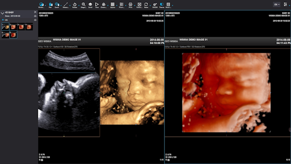 Teleray Reviews, Demo & Pricing - 2022