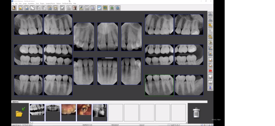 Gendex VixWin Platinum Pricing, Cost & Reviews - Capterra UK 2025
